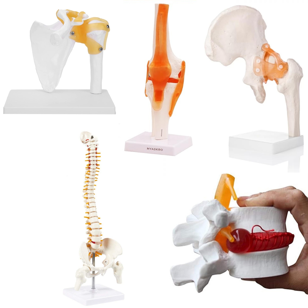 Orthopedic Joint & Spine Anatomy Model Bundle – Includes Spine, Knee, Shoulder, Hip, and Lumbar ...